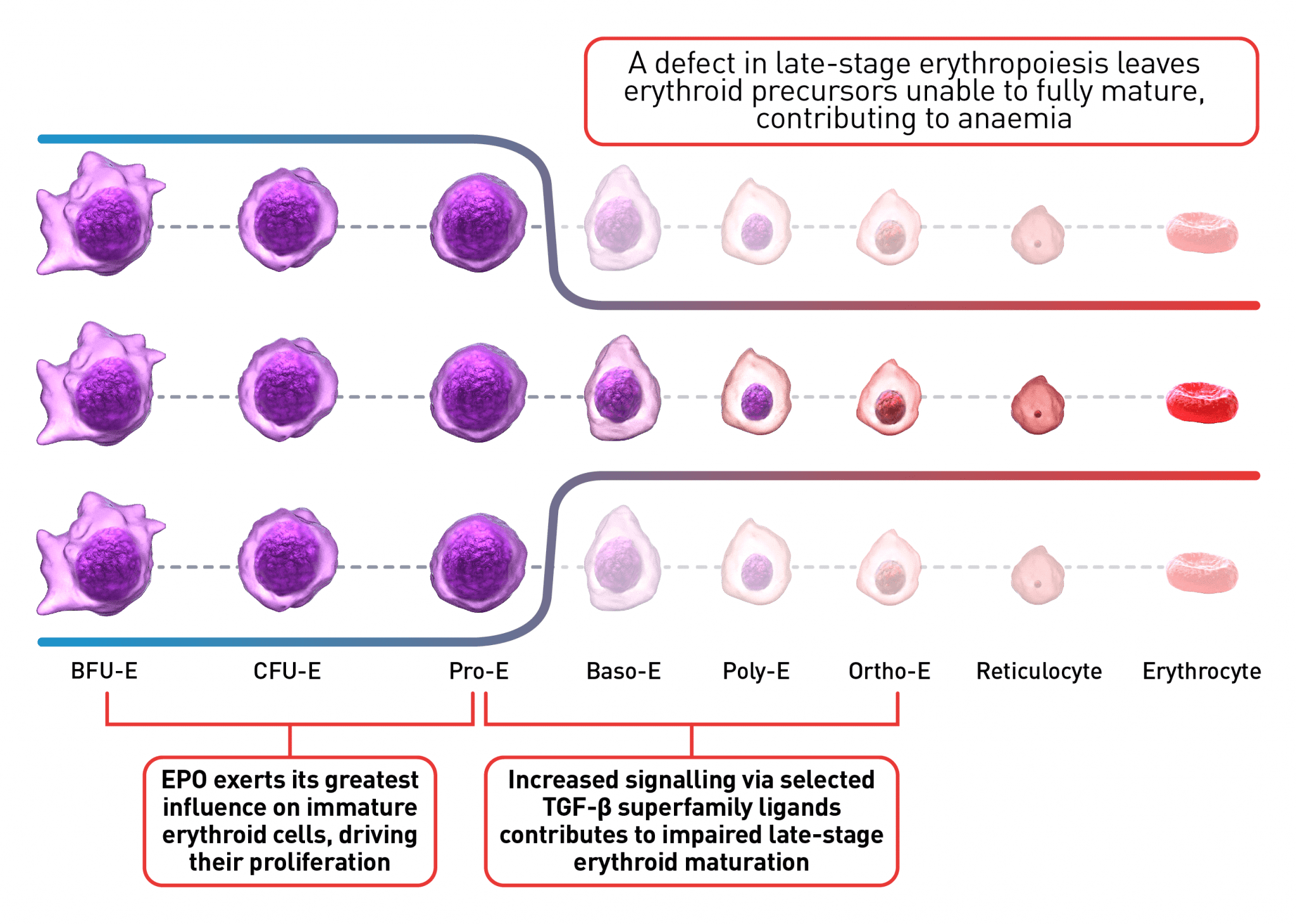 Erythroid-maturation-defect Erythroid-maturation-defect