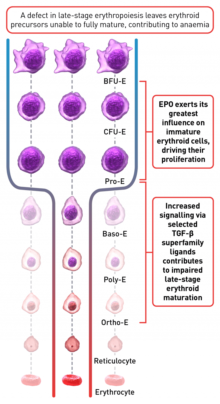 Erythroid-maturation-defect Erythroid-maturation-defect